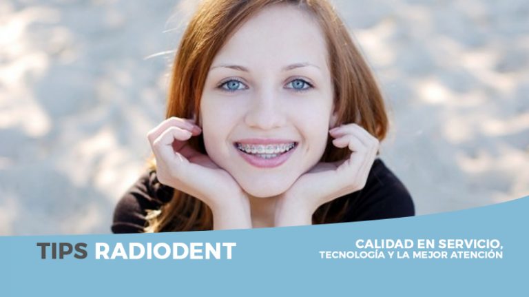 ¿QUÉ HACER CUANDO SE ROMPE UN BRACKET? – Radiodent